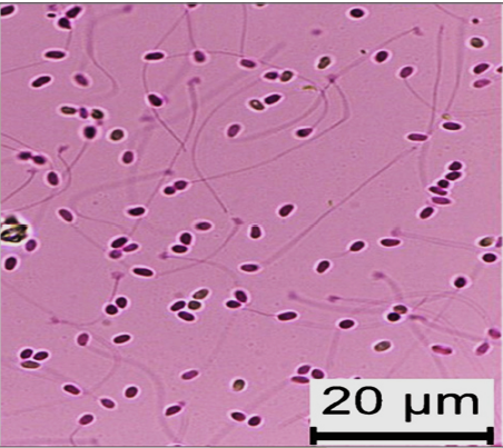 Research progress on shrimp microsporidian EHP and Early Mortality ...